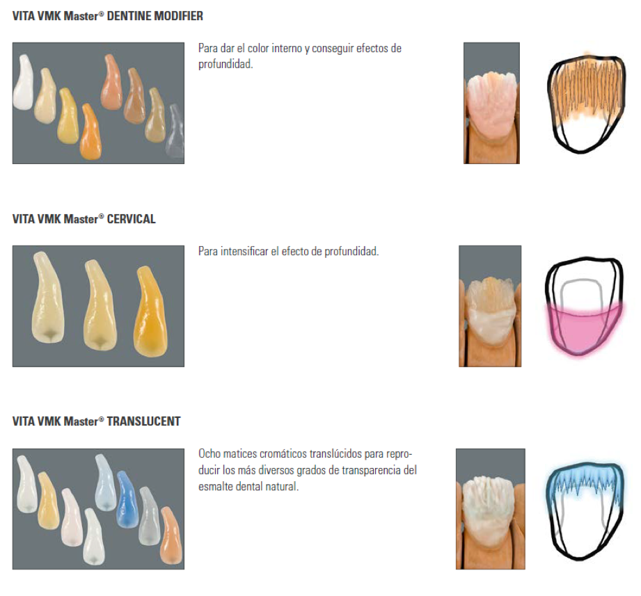 VMK Master – Dental Laval